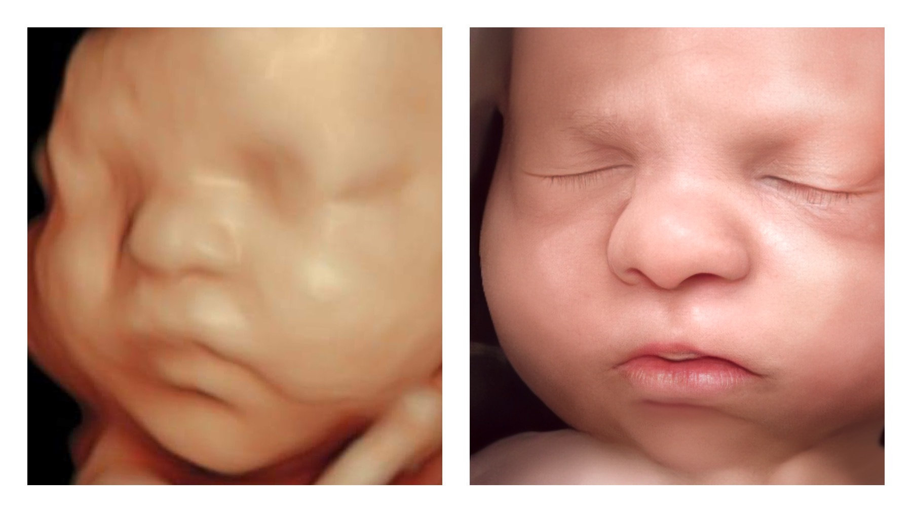 8k image NEW - First Glimpse Ultrasound